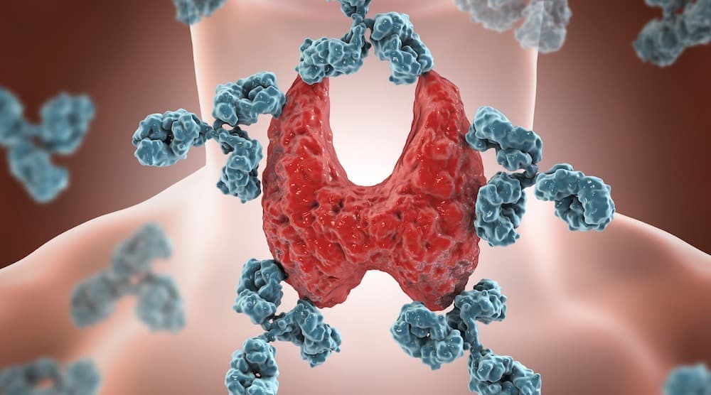 Hashimoto’s Thyroiditis Diagnosis? What You Need to Know – Organixx