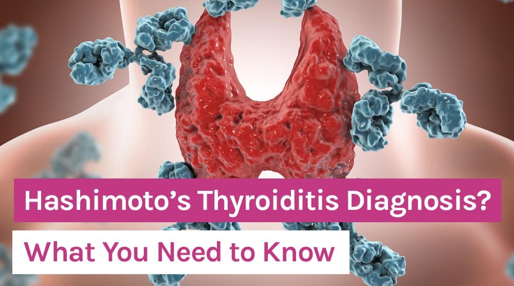 Hashimoto’s Thyroiditis Diagnosis? What You Need to Know - Organixx