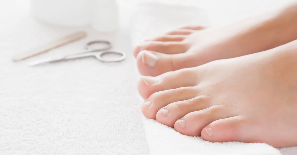 Natural Remedies to Control and Eliminate Toenail Fungus and Ringworm ...