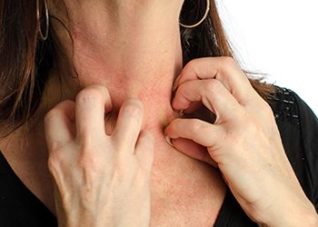 Turmeric and Skin: 5 Ways Turmeric Root Is Used to Help Protect & Heal ...